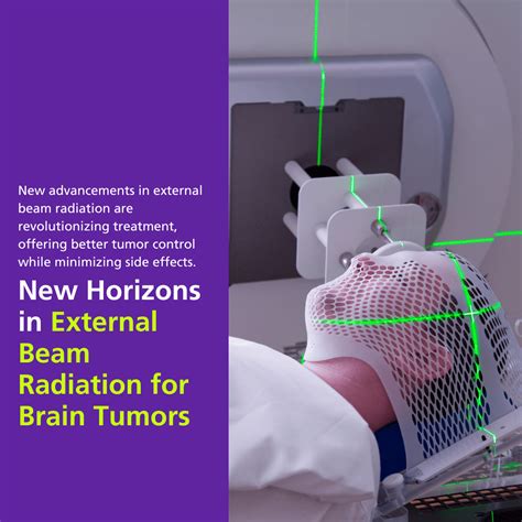 Diffuse Midline Glioma Dmg American Brain Tumor Association