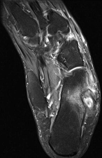 Ankle Musculoskeletal Key