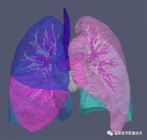 肺部ct全器官结构分割 腾讯云开发者社区 腾讯云