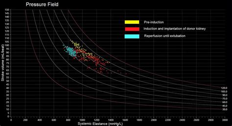 A Software Guided Approach To Hemodynamic Management In A Re Aanda Practice