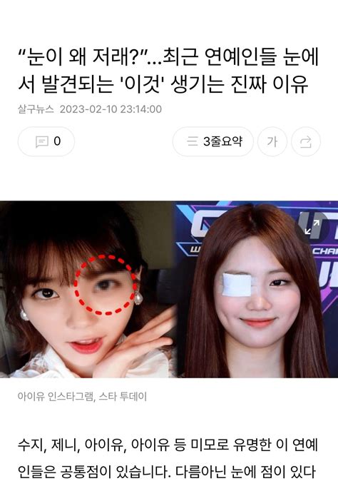 눈이 왜 저래” 최근 연예인들 눈에서 발견되는 이것 생기는 진짜 이유 10 Things Quick