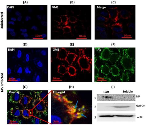 Host Lipid Rafts Play A Major Role In Binding And Endocytosis Of Influenza A Virus