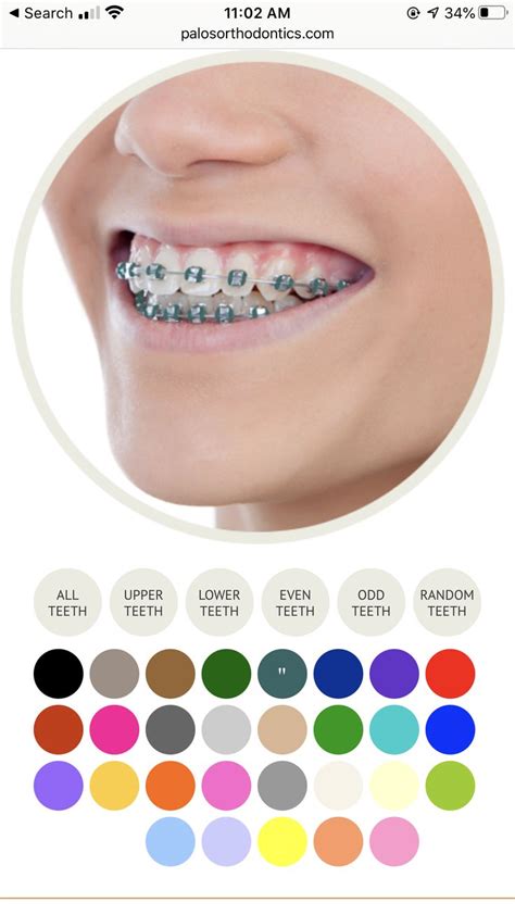The Alluring Appeal Of Teal Braces Color A Comprehensive Guide