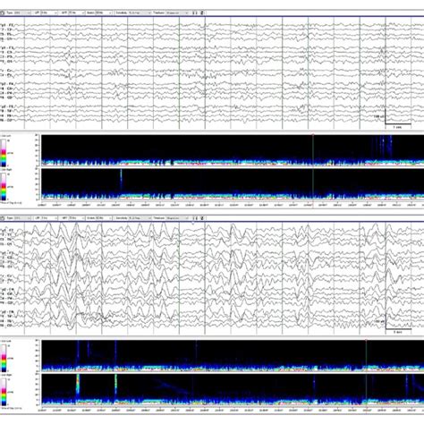 10 Algorithm For The Medical Treatment Of Catatonia Download Scientific Diagram
