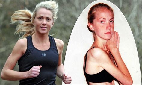 Eating Disorder Recovering Anorexic Once Weeks From Death Puts Best