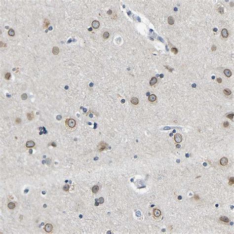 Rabbit Polyclonal Anti Ranbp2 Antibody Buy For Research Highly Specific Rigorously