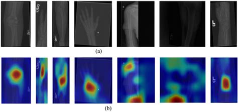 Diagnostics Special Issue Artificial Intelligence In Medical Image
