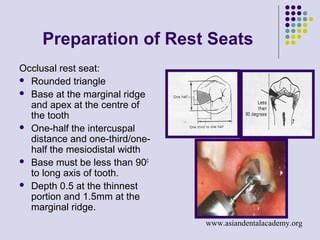 Indirect Retainers For Removable Partial Dentures Ppt