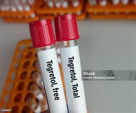 카르바마제핀의 혈중 농도를 평가하는 테그레톨 검사용 혈액 샘플 Carbatrol Epitol Equetro Tegretolxr
