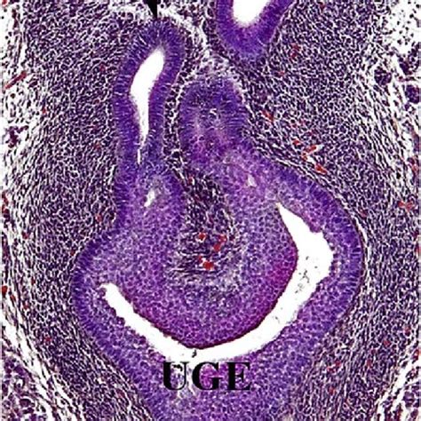 Sections Of Canalized Human Fetal Prostatic Ducts From 15 To 19 Week Download Scientific