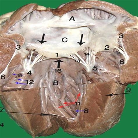 The Left Ventricular Cavity A The Left Ventricular Cavity Showing The Download Scientific