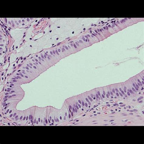 Cil 34864 Homo Sapiens Epithelial Cell Foam Cell Cil Dataset