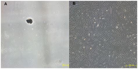 A The Adherent Cells The Cells Had Migrated Out Of Umbilical Cord At 3