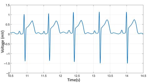 Original Ecg Signal Download Scientific Diagram