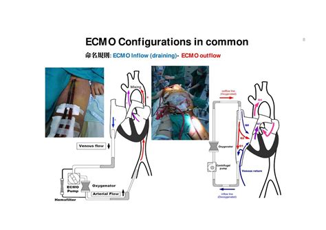 Ecmoconfiguration1