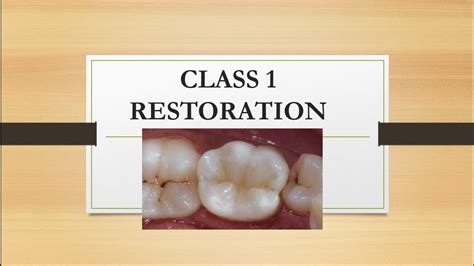 Restoration 1