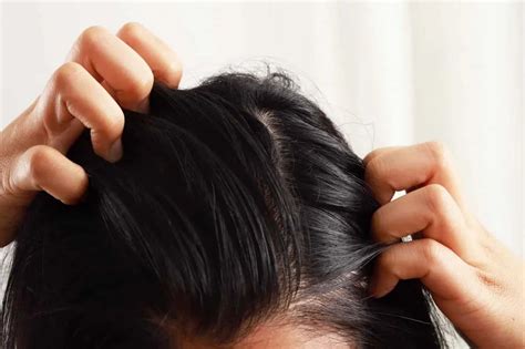 جلوگیری از ریزش مو روش های موثر پیشگیری از ریزش مو