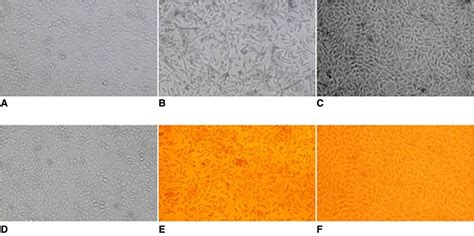 Characterization And Potential Antitumor Effect Of A