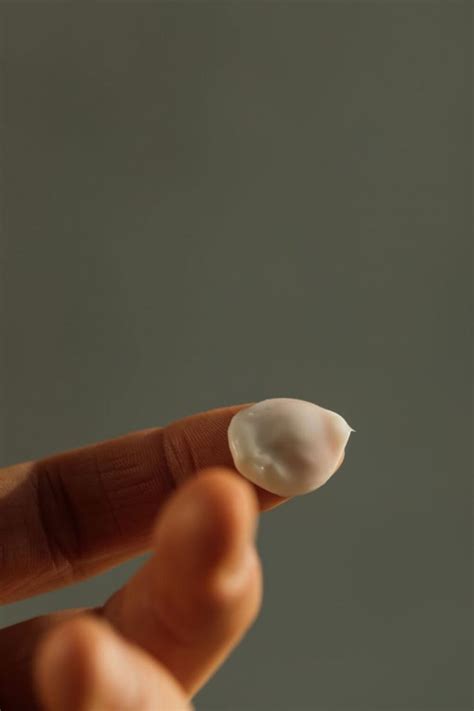 Milia Bumps On Hands Skincal
