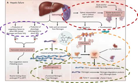 Acquired Coagulation Disorders Liver Disease And Vitamin K Deficiency