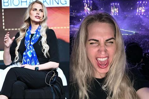 La “benjamin Buttom” De La Vida Real Liz Parrish La Mujer Que Desafía