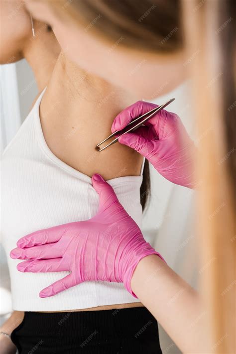 El Dermatólogo Examina Los Lunares O Las Marcas De Nacimiento De Una