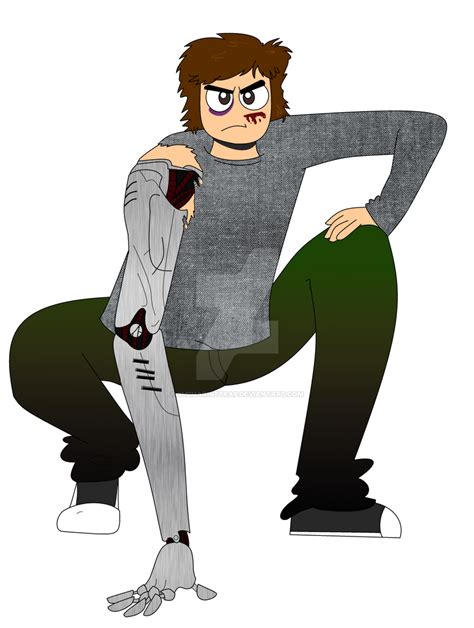 Bionic Arm By Korydile On Deviantart