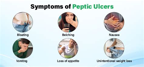 Peptic Ulcer Causes Symptoms And Effective Treatment