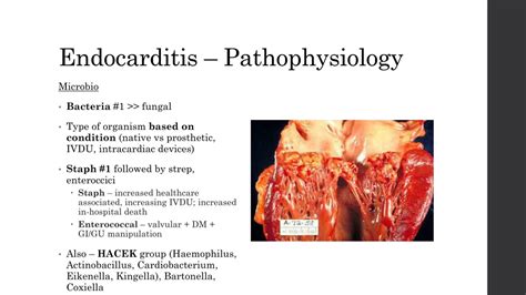 Ppt Infectious Disease Endocarditis Serious Viral Infections Powerpoint Presentation Id 393239