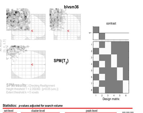 Alignment Issues In Spm Analysis Of Adni Pet Scans Software Support