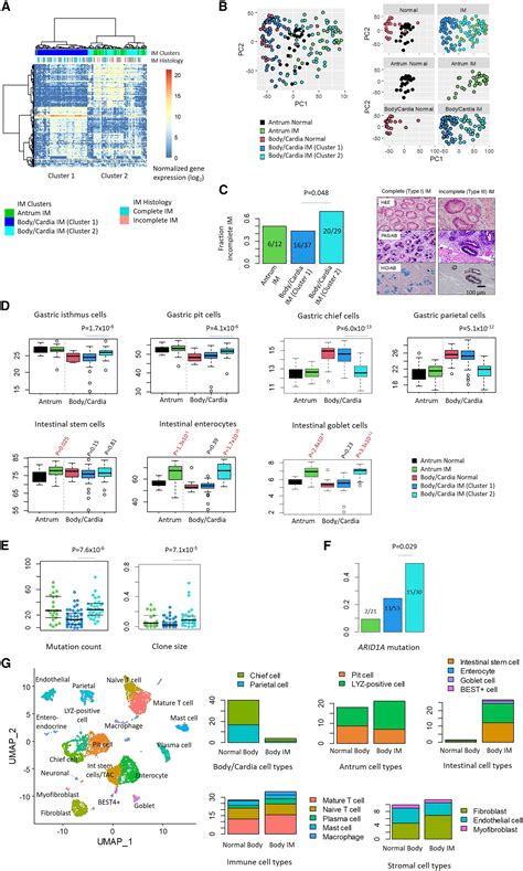 Spatiotemporal Genomic Profiling Of Intestinal Metaplasia Reveals Clonal Dynamics Of Gastric