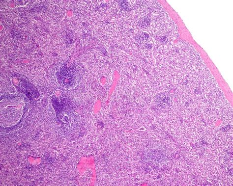 Human Spleen Stock Image Image Of Histological White 308548867