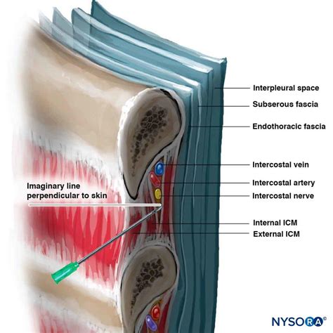 Dental Nerve Block Procedure Note At Samantha Keegan Blog