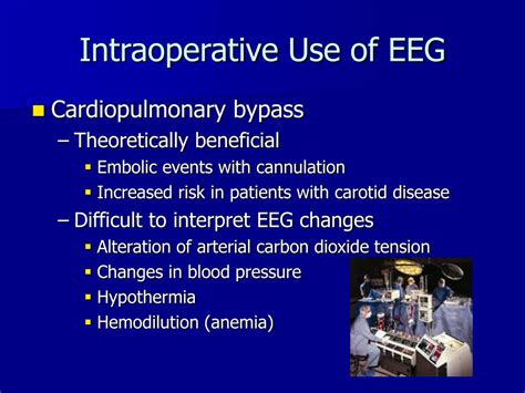 Ppt Neurological Monitoring Powerpoint Presentation Free Download Id 397347