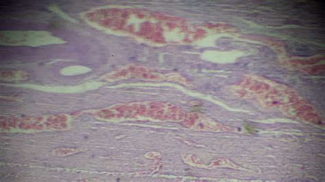 40 Viral Warts Stock Videos Footage And 4k Video Clips Getty Images