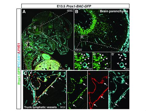 Prox1 Is Not Expressed In The Developing Cns Vasculature Section