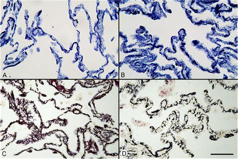 Morphological Analysis Of The Features Of Elastic And Reticular Fibers