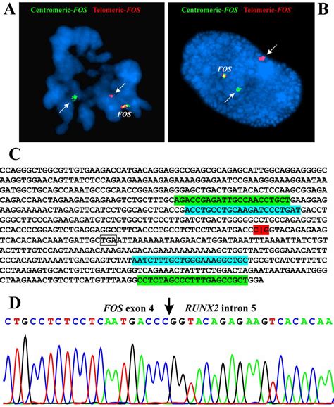 Fos Ankh And Fos Runx2 Fusion Genes In Osteoblastoma Cancer Genomics