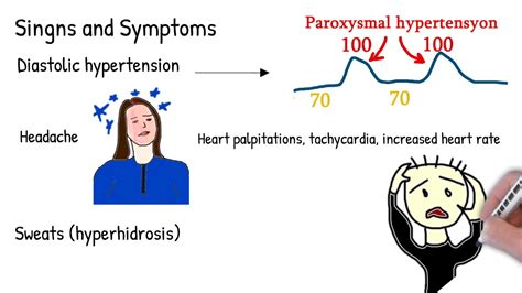 Pheochromocytoma Symptoms Causes Treatment Made Simple Youtube