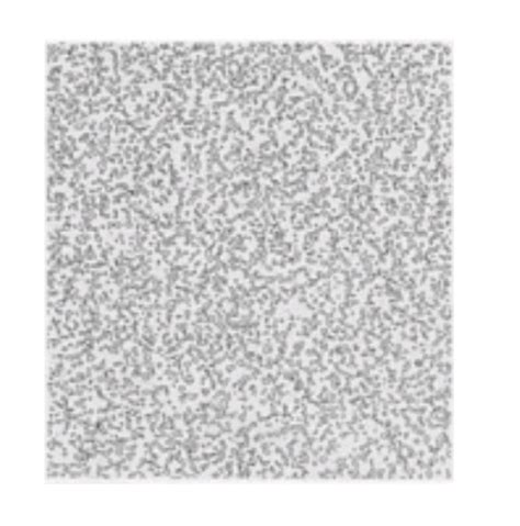 Gopi M On Linkedin S45c Grade Spheroidization Annealing Microstructure