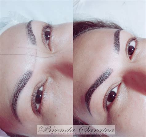 Brenda Saraiva Reforma De Procedimento Antigo Feito Por Facebook