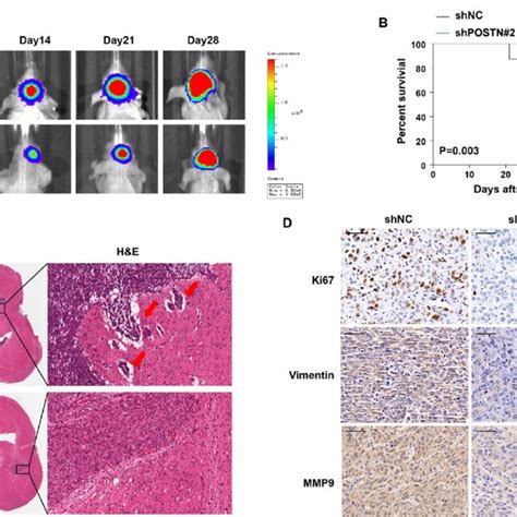 Postn Downregulation Inhibits Glioma Progression In Vivo A