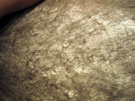 The Story Behind The Pictures Day Cat With Skin Issues