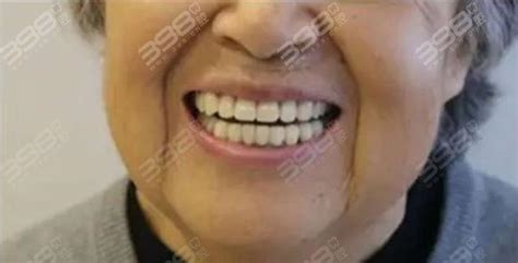老年人缺牙会更容易患老年痴呆吗 我们该为父母更关注缺牙导致的身体问题 知乎