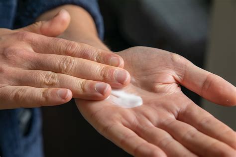 3 Best Lotions For Dry Diabetic Skin Of 2025 Carewell