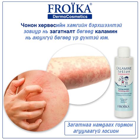 Froika Mongolia ЧОНОН ХӨРВӨС гэж юу вэ Арьсан дээр