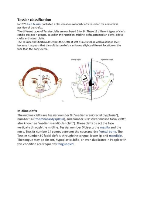 Tessier Classification For Orthodontist By Almuzian