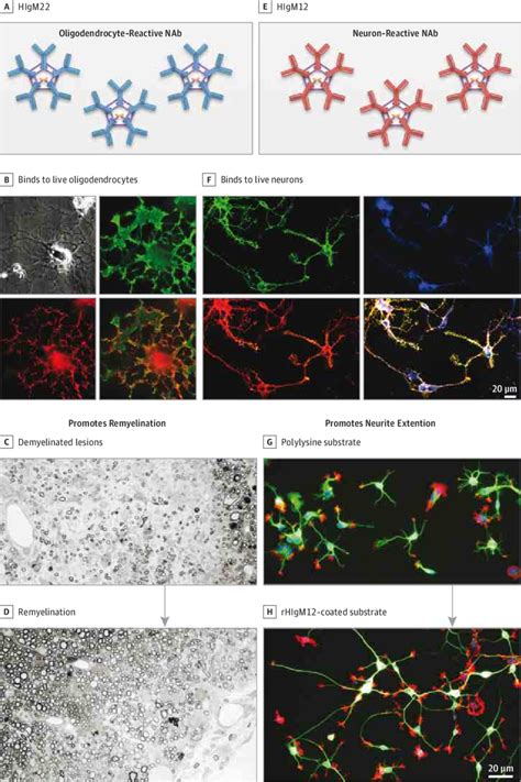 Oligodendrocyte And Neuron Reactive Antibodies Download Scientific