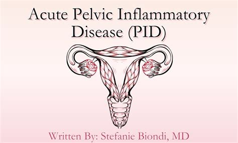 Pelvic Inflammatory Disease Core Em