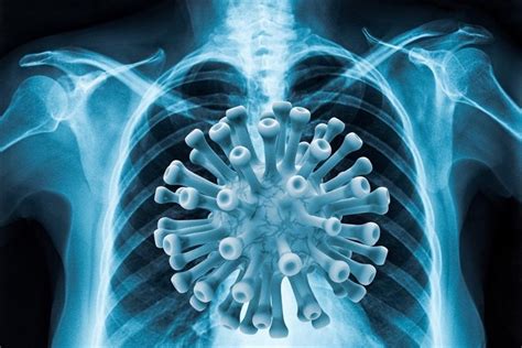 Frequency And Function Of SARS CoV Specific T Cells In Individuals With Pulmonary PASC